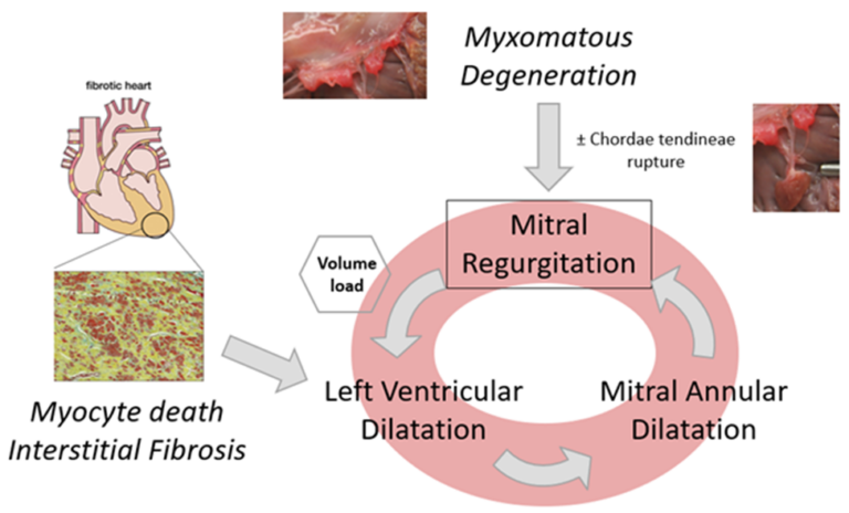 Updates on Treating Congestive Heart Failure, Part 3: Which Treatments ...